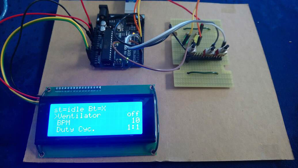 Open Source Code Available for Ventilators - Showcase - Arduino Forum