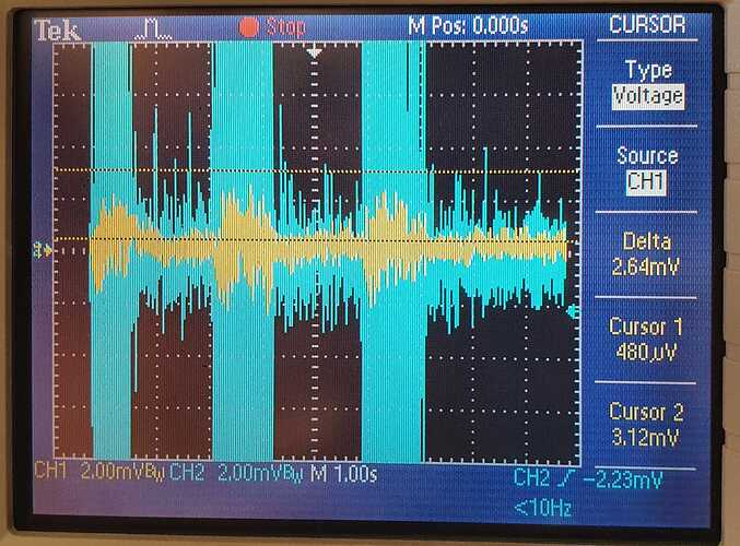 Reading EMG signal using analogread() - General Guidance - Arduino Forum