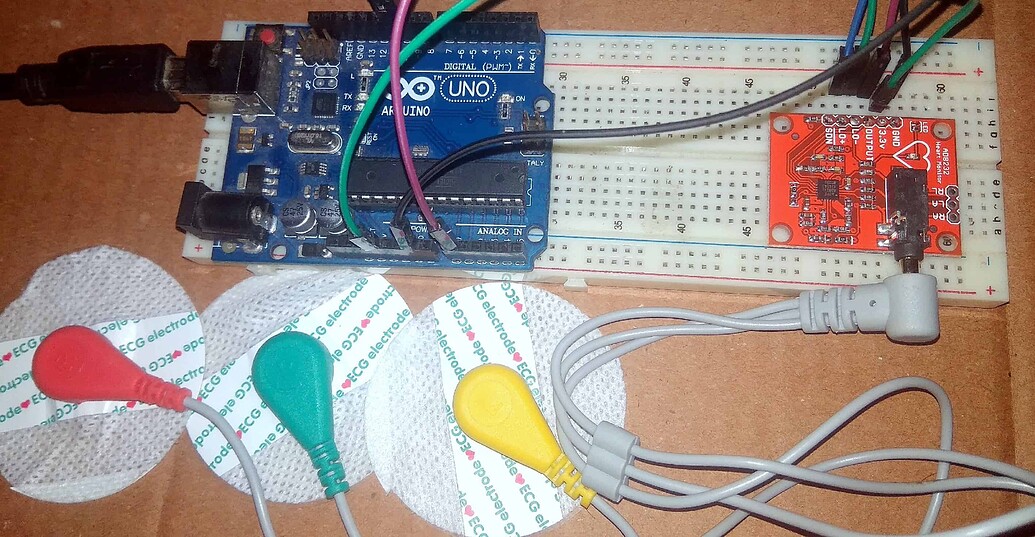 Serial Heart Monitor Bugs- Arduino AD8232 - General Guidance - Arduino Forum