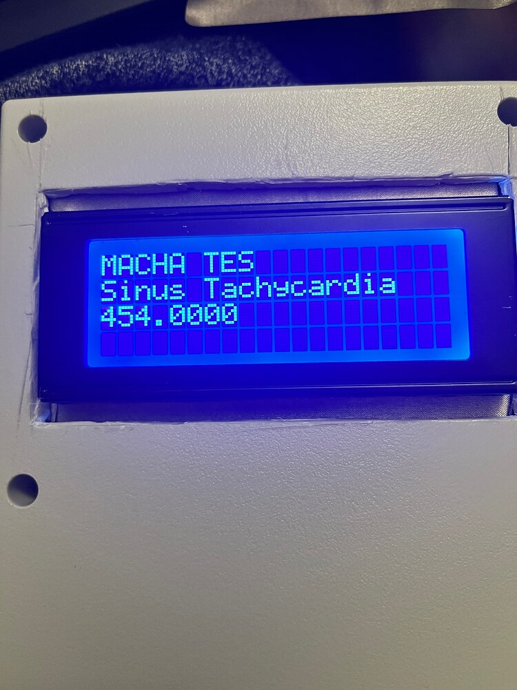BPM coding incorrect - Programming - Arduino Forum