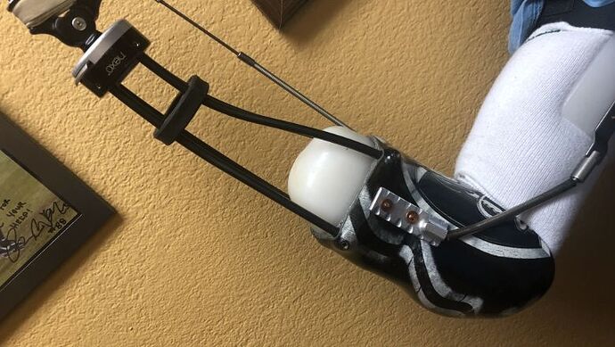 Paralyzed arm exoskeleton - General Guidance - Arduino Forum