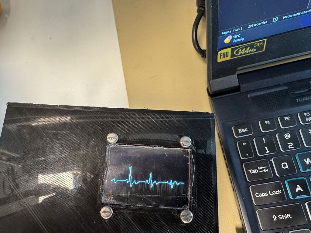 Problems showing ECG signal on display (Incoming signal on A1 is good) - General Guidance ...