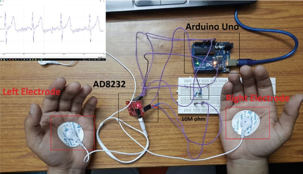 ECG two electrode mode - AD8232 - Sensors - Arduino Forum