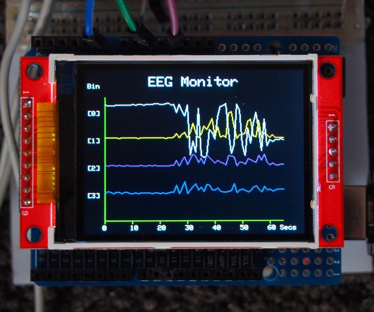 Señal EEG sin utilizar OpAmp para sumar otra señal - Español - Arduino Forum