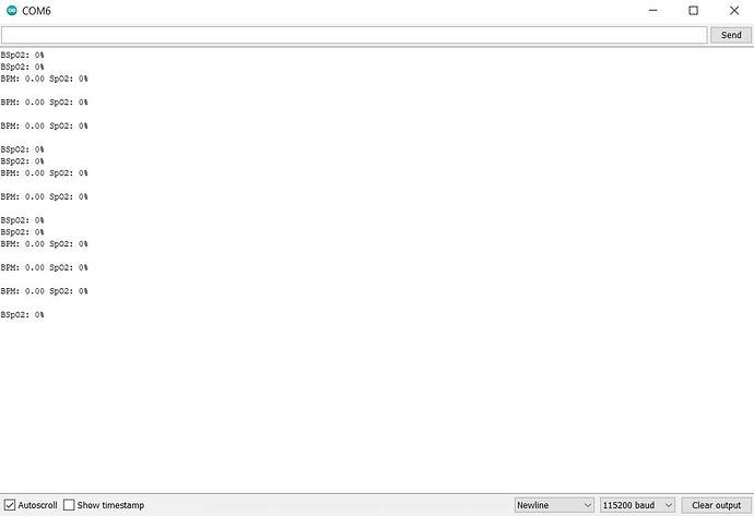 HC-05 Bluetooth module - laggy transmition - Programming - Arduino Forum