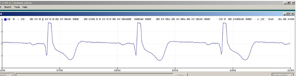 Problem with AD8232 ECG WaveForm - General Guidance - Arduino Forum