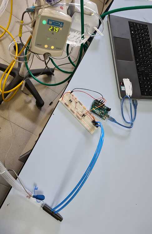 Arduino serial monitor giving constant value for pressure drop ...