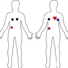 Problem with AD8232 ECG WaveForm - General Guidance - Arduino Forum
