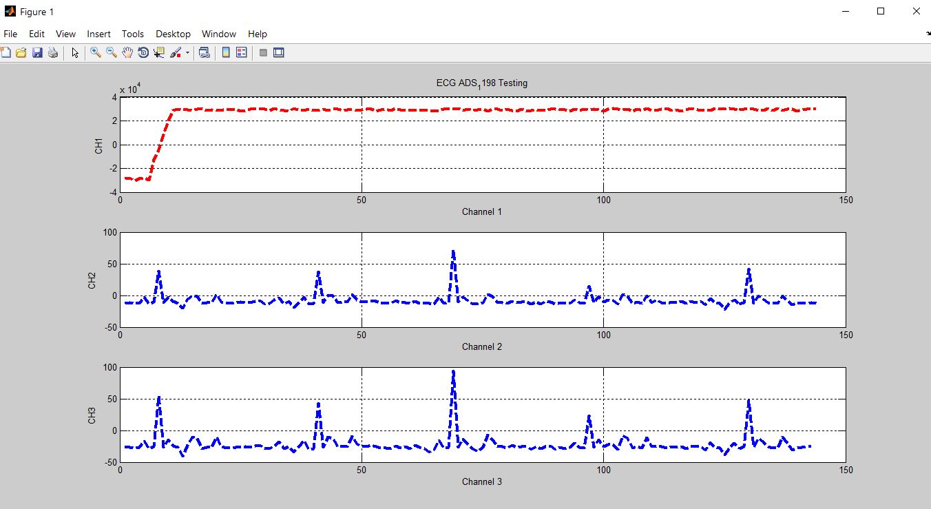 Arduino And Ti Ads1298 Way Of Data Out Suggestion General Guidance