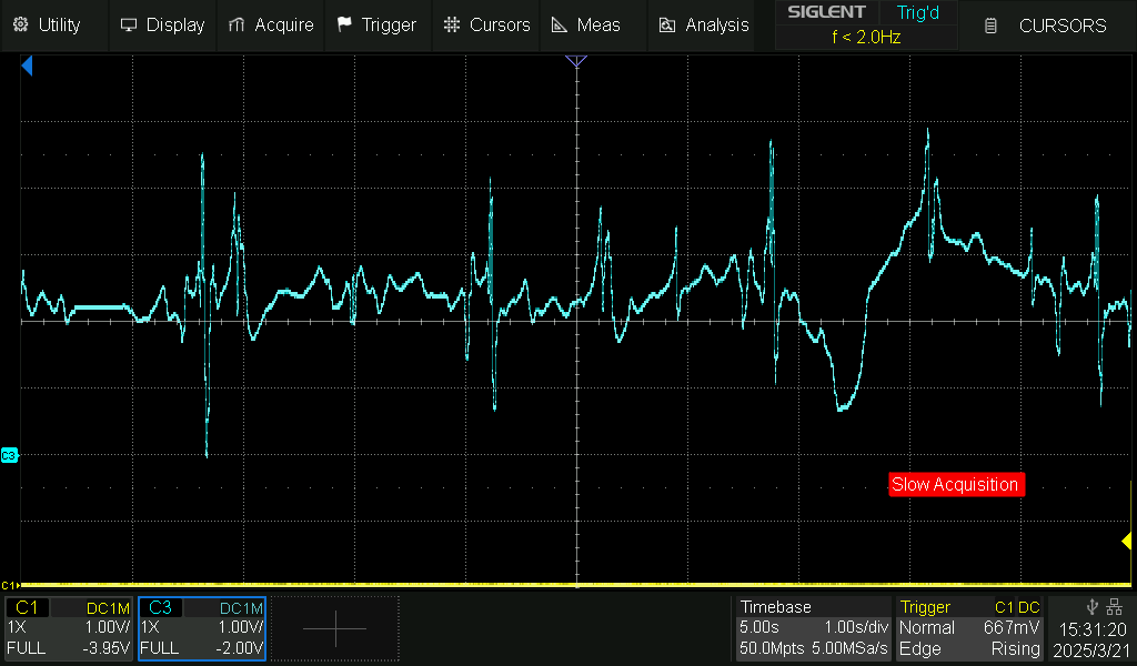 Arduino Serial Plotter Not Displaying Negative Values for EMG Signal - Page 2 - Sensors ...