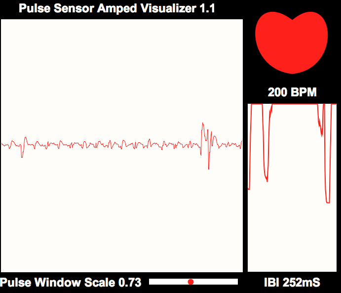 Pulse Heart Sensor sending data but 0 BPM? - Sensors - Arduino Forum