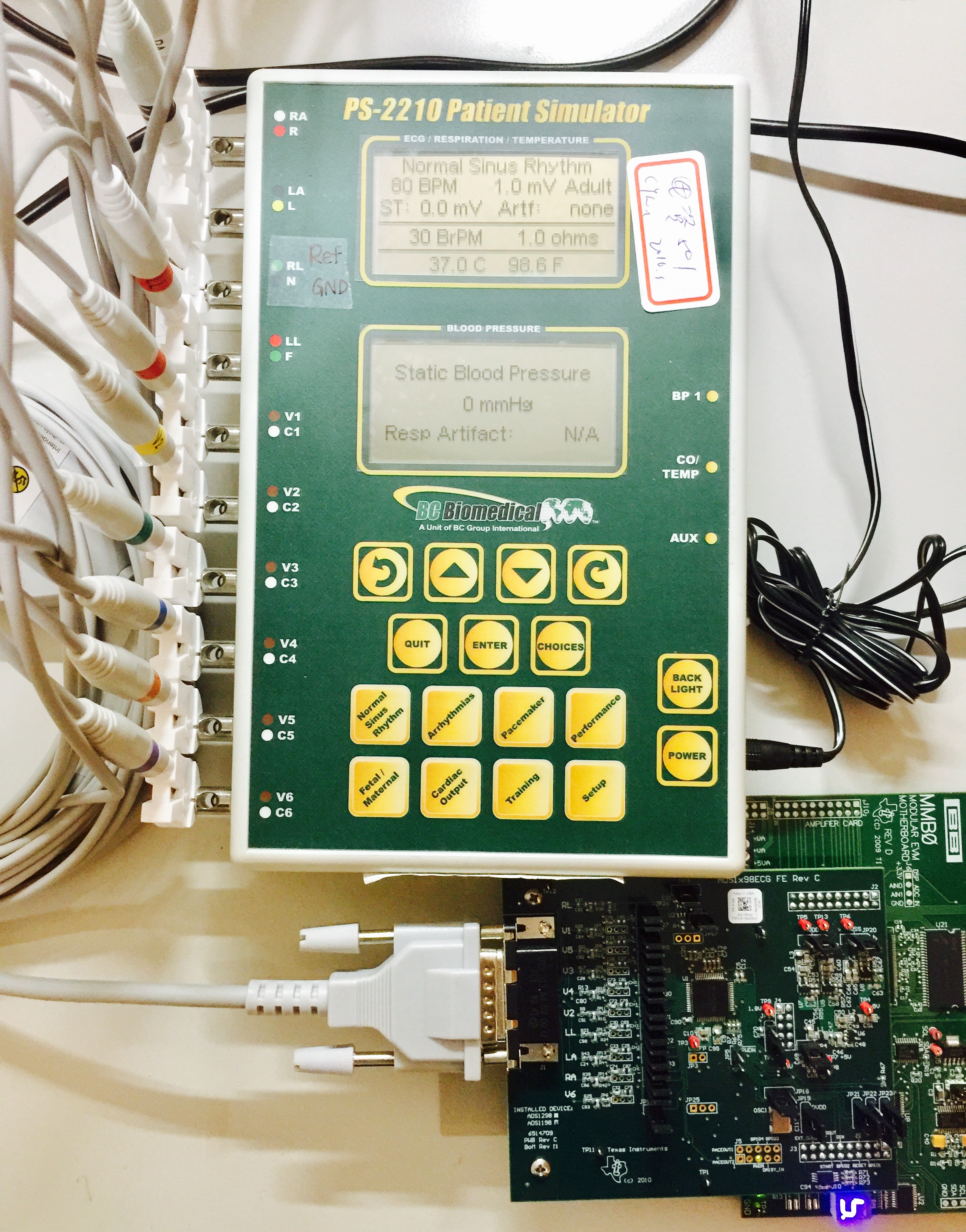 Arduino And Ti Ads1298 Way Of Data Out Suggestion General Guidance Arduino Forum 6256