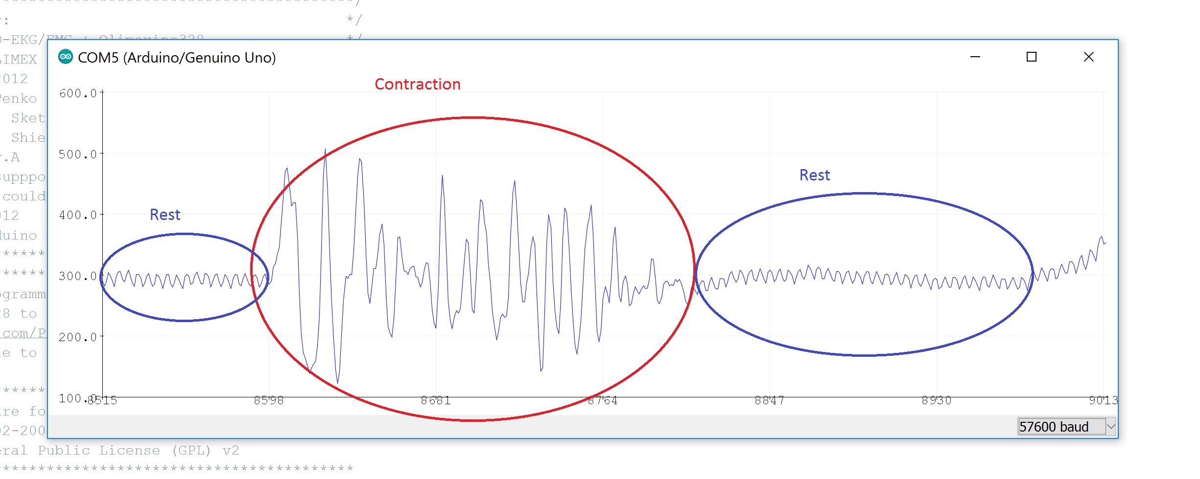 Stem Cells research : EMG required - Programming - Arduino Forum