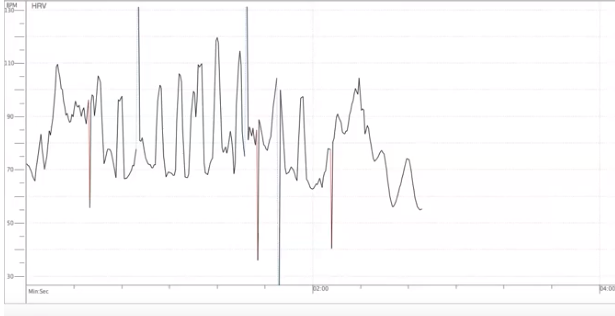 I want to measure HRV - General Guidance - Arduino Forum