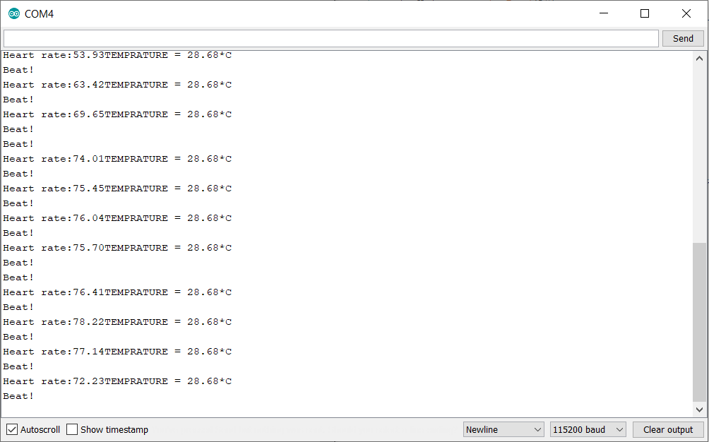 Max30100 Value Not Reading When Using Postdata In Code Sensors Arduino Forum