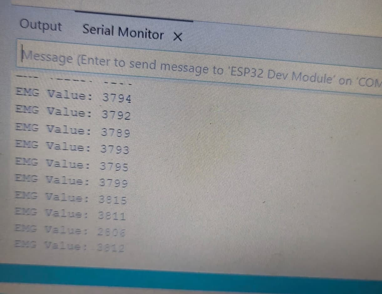 Myoware 2.0 not responding to muscle activation - General Guidance - Arduino Forum