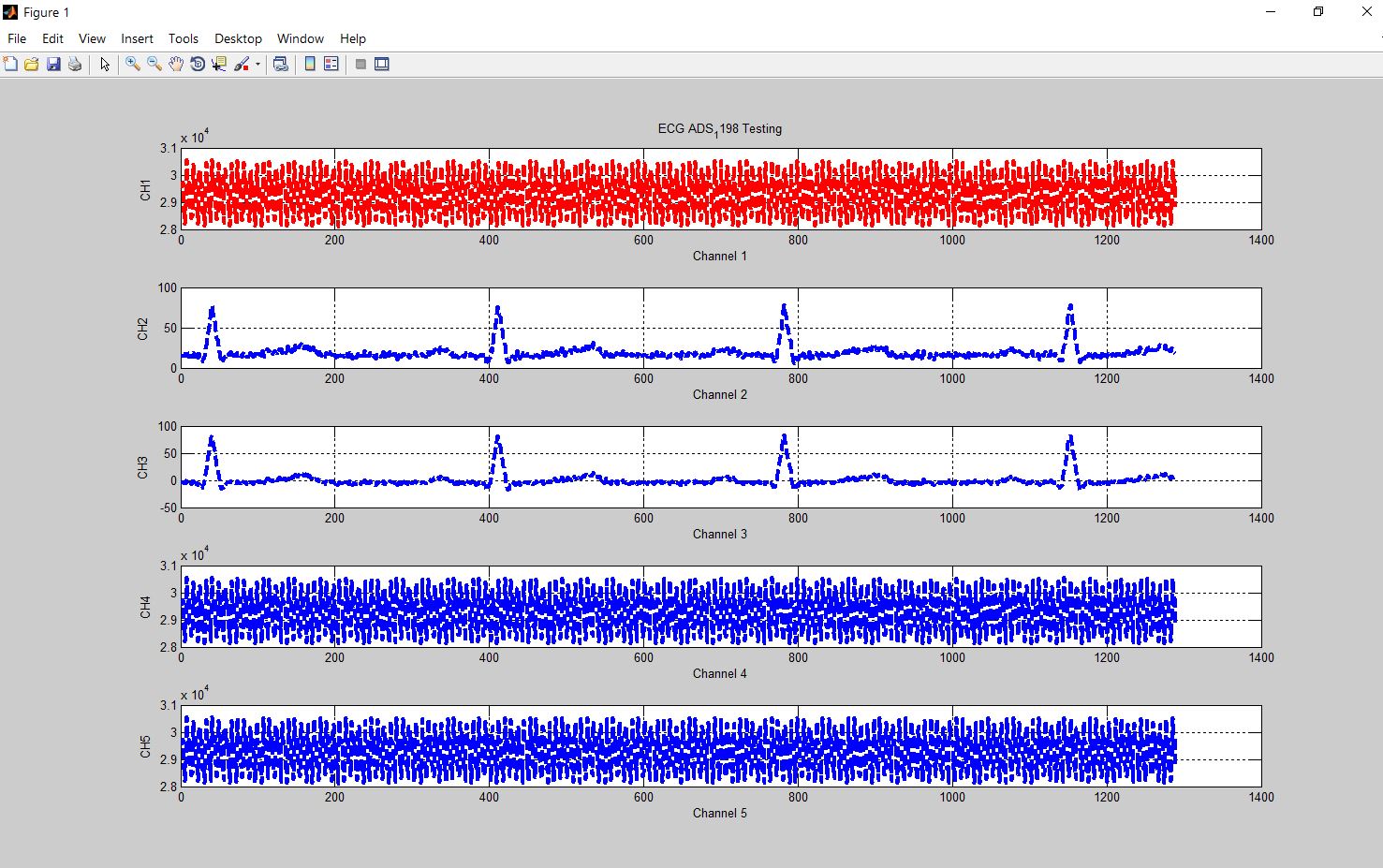 Arduino And Ti Ads1298 Way Of Data Out Suggestion General Guidance