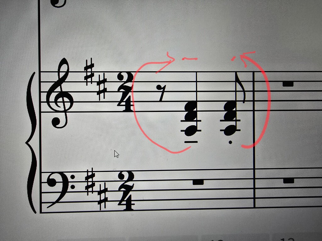 How to type over tenuto staccato notes - Dorico - Steinberg Forums