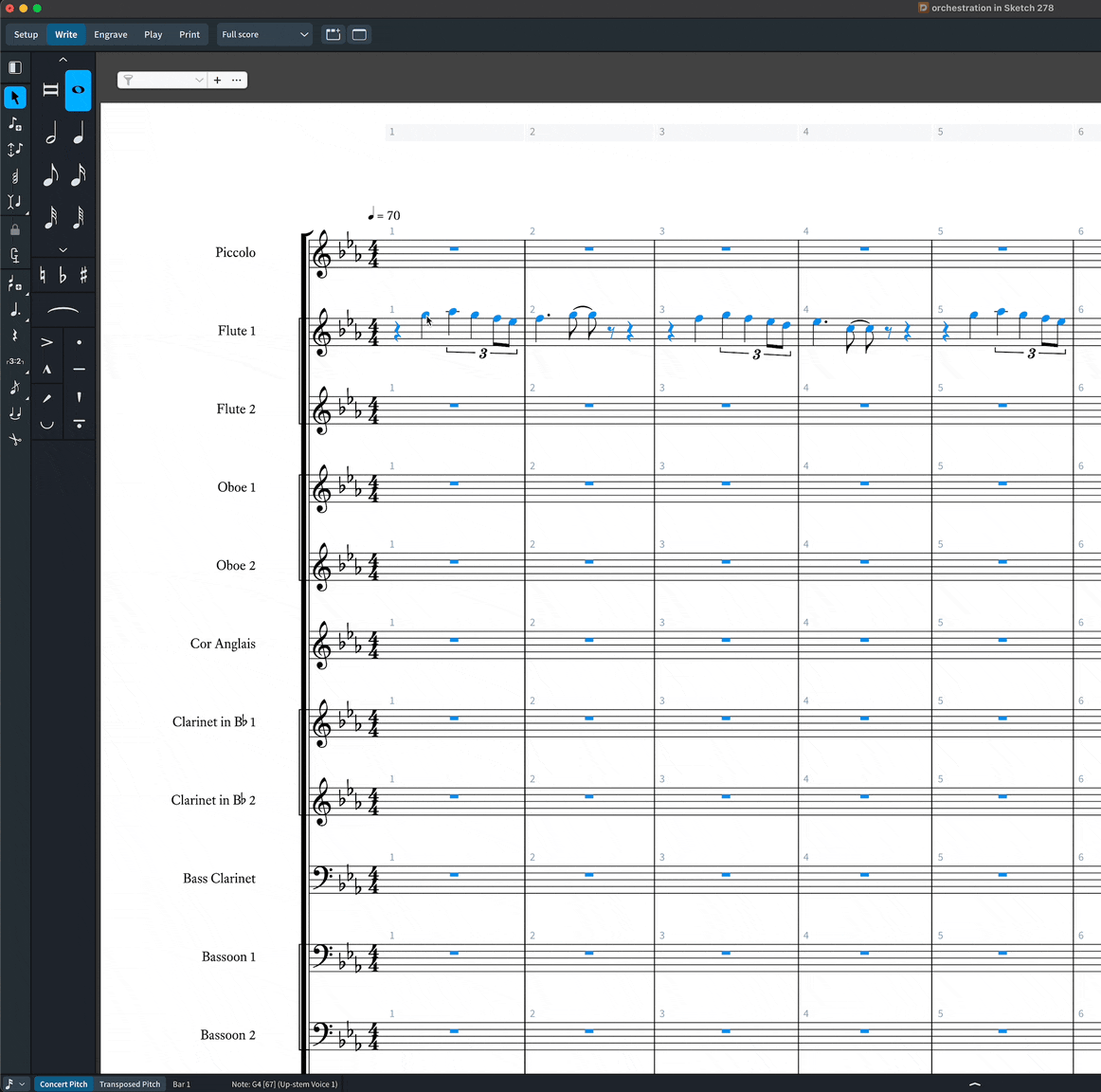 Strange Undo Redo Scrolling Behavior 2 By Wing Dorico Steinberg Forums