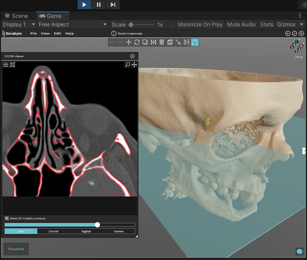 Substitution for geometry shader on Metal - Unity Engine - Unity Discussions